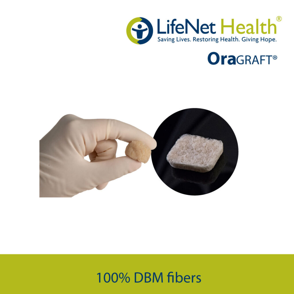 100% DBM fibers - Galla Dental